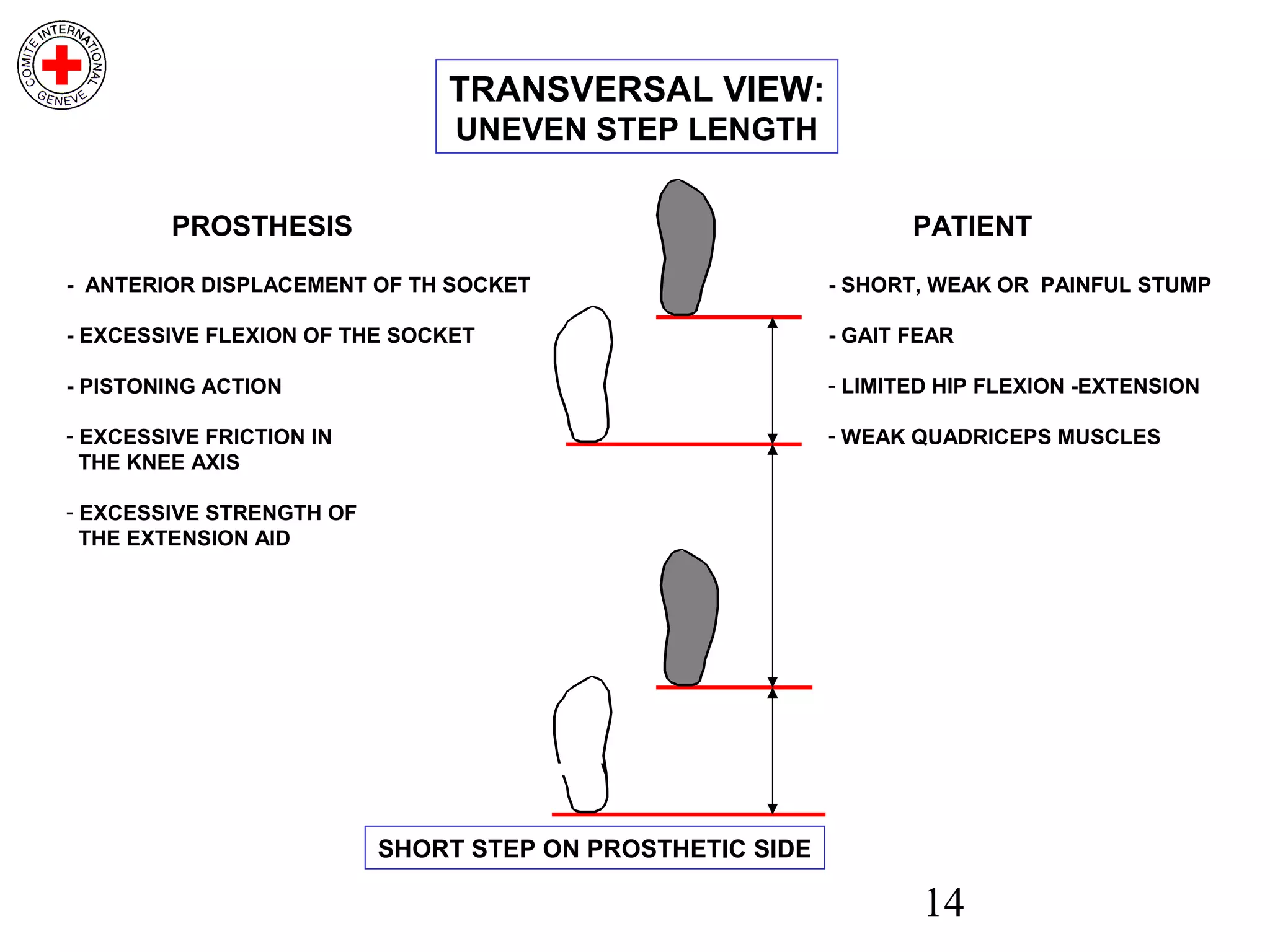 Transfemoral Gait Deviations | PPT