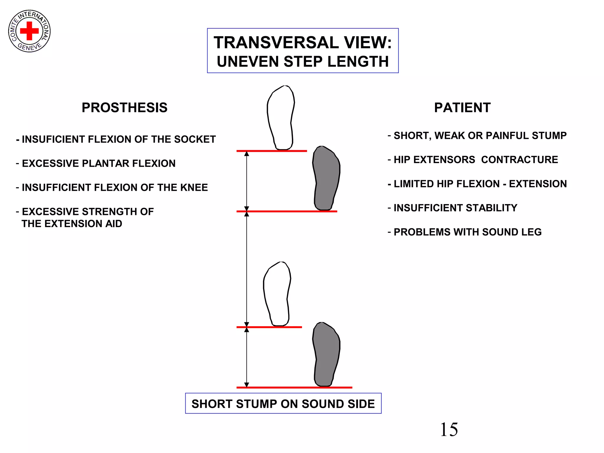 Transfemoral Gait Deviations | PPT