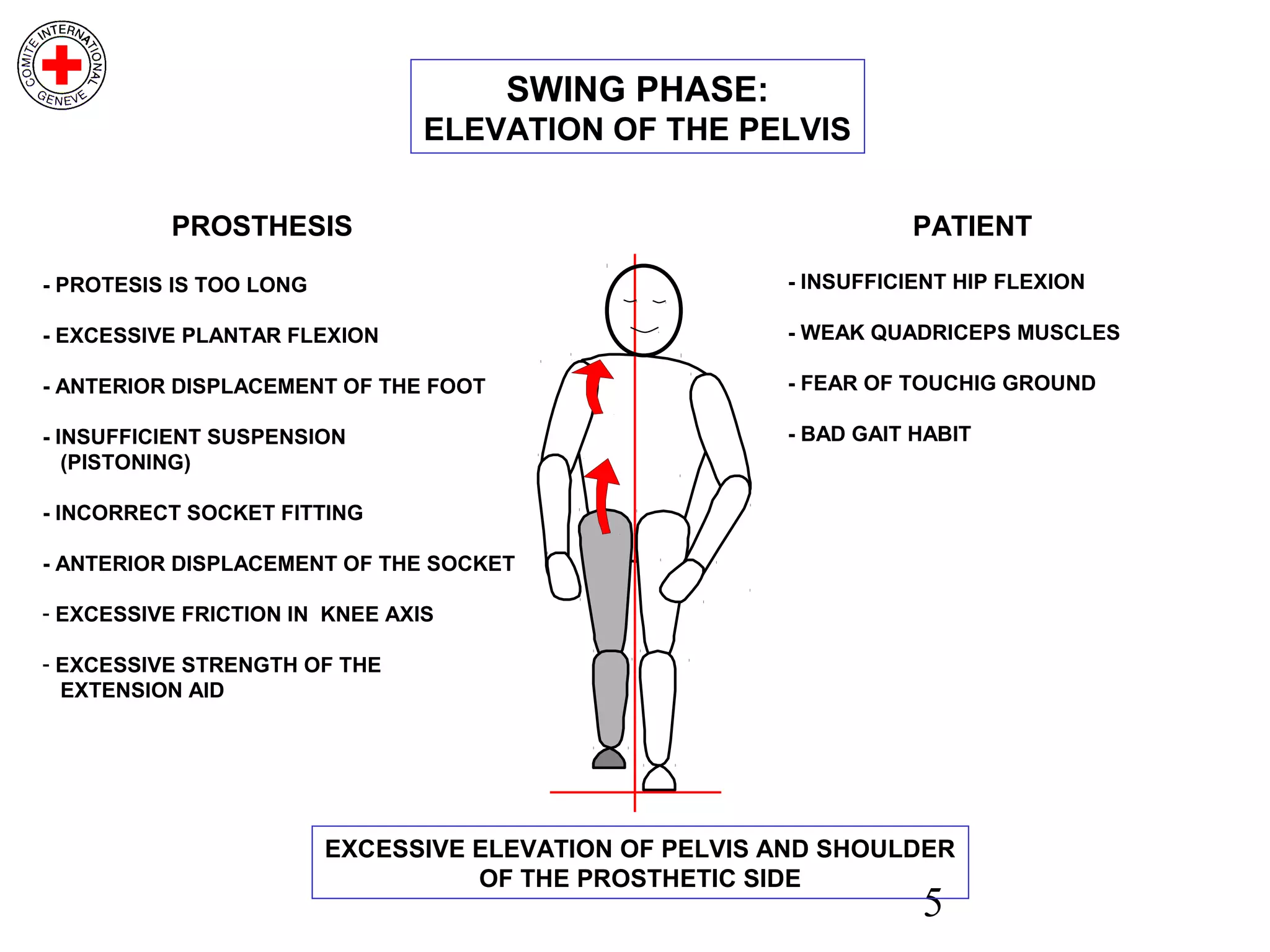 Transfemoral Gait Deviations | PPT