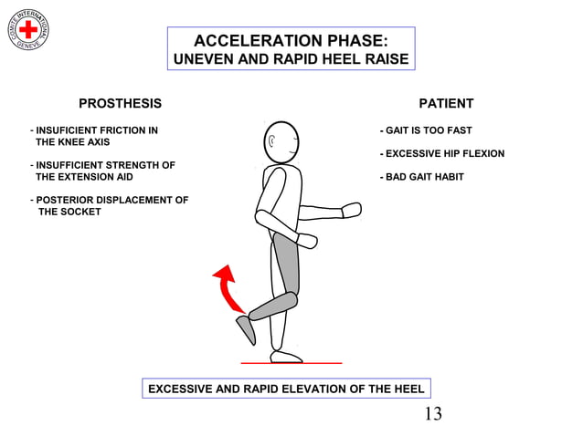 Transfemoral Gait Deviations | PPT