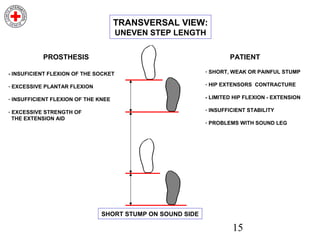 Transfemoral Gait Deviations | PPT