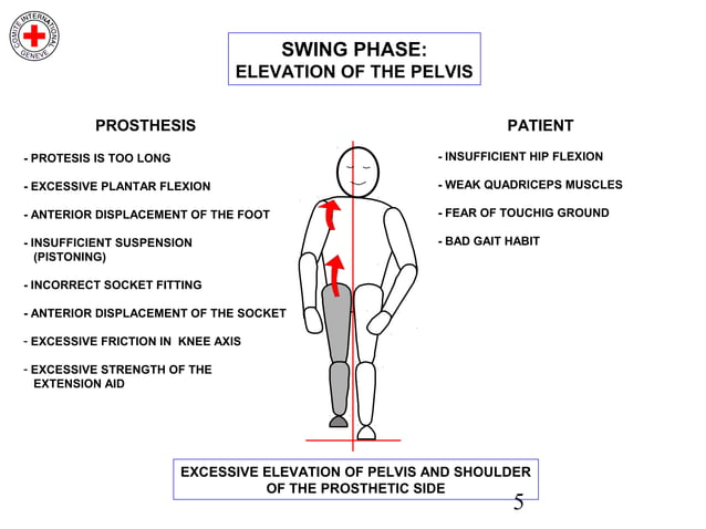 Transfemoral Gait Deviations | PPT