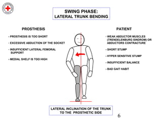 Transfemoral Gait Deviations | PPT