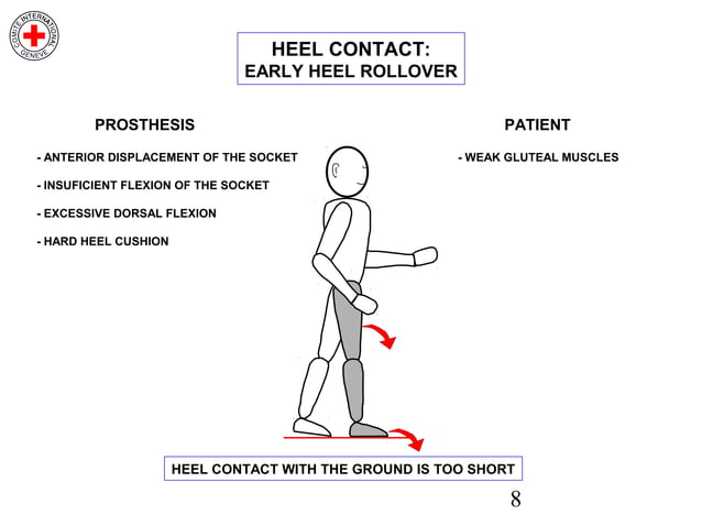Transfemoral Gait Deviations | PPT