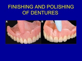 13. finishing & polishing | PPT