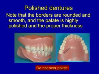 13. finishing & polishing | PPT