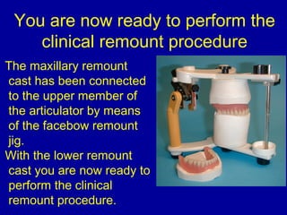 13. finishing & polishing | PPT