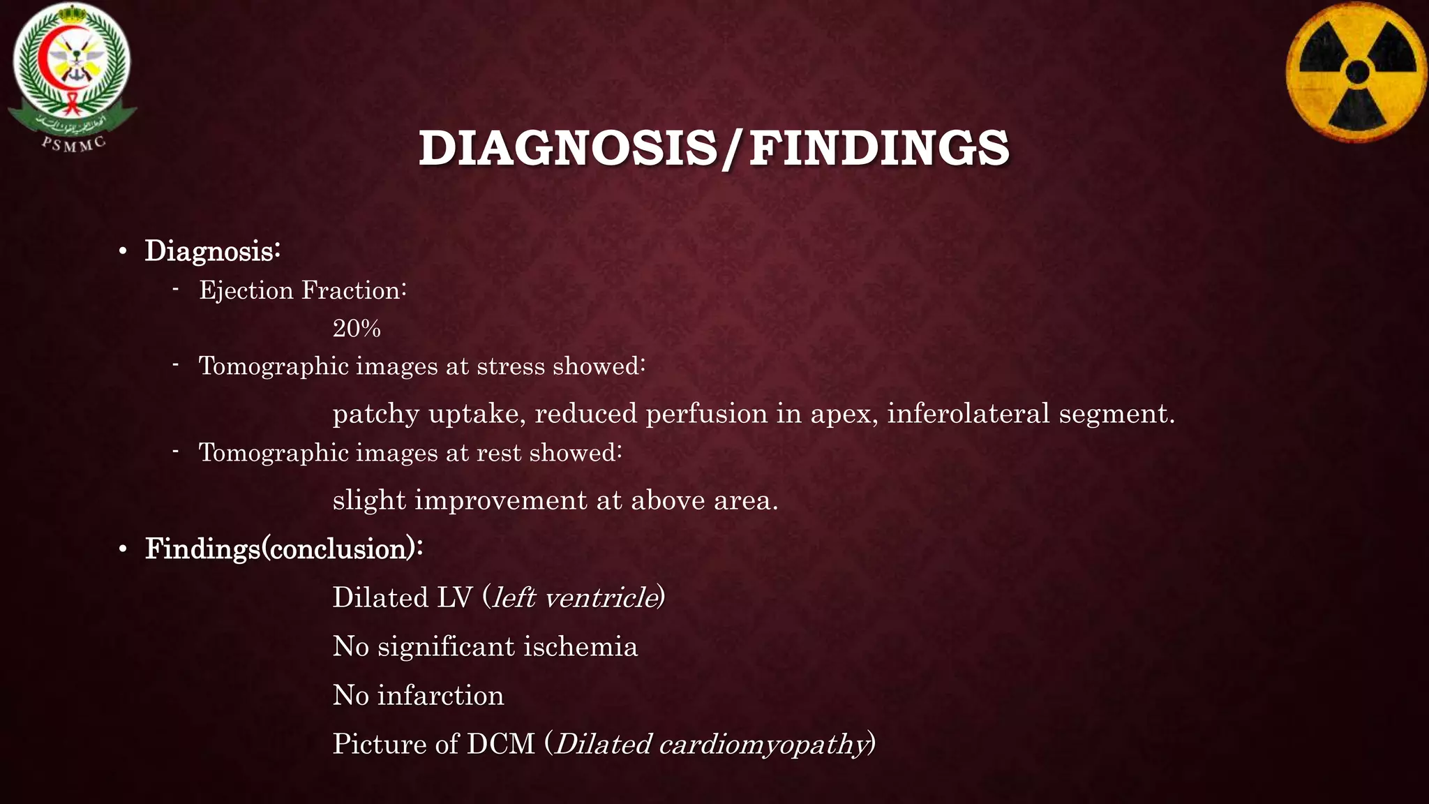 Nuclear Medicine - MPI - Case Study | PPTX