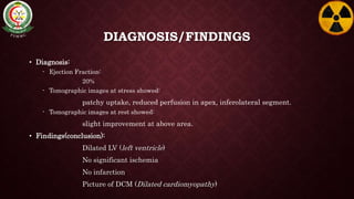 Nuclear Medicine - MPI - Case Study | PPT