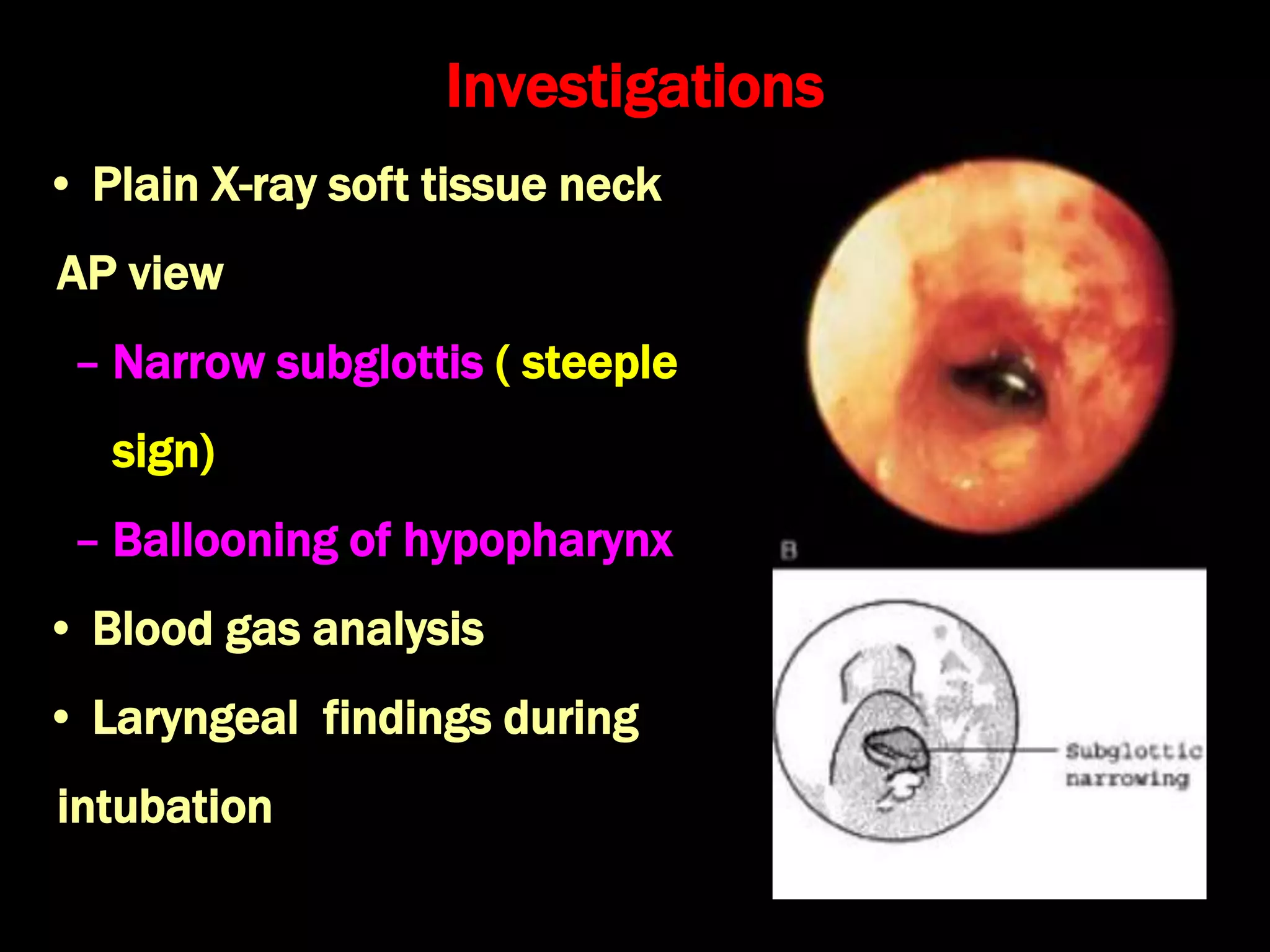 Acute and chronic laryngeal inflammations | PPT