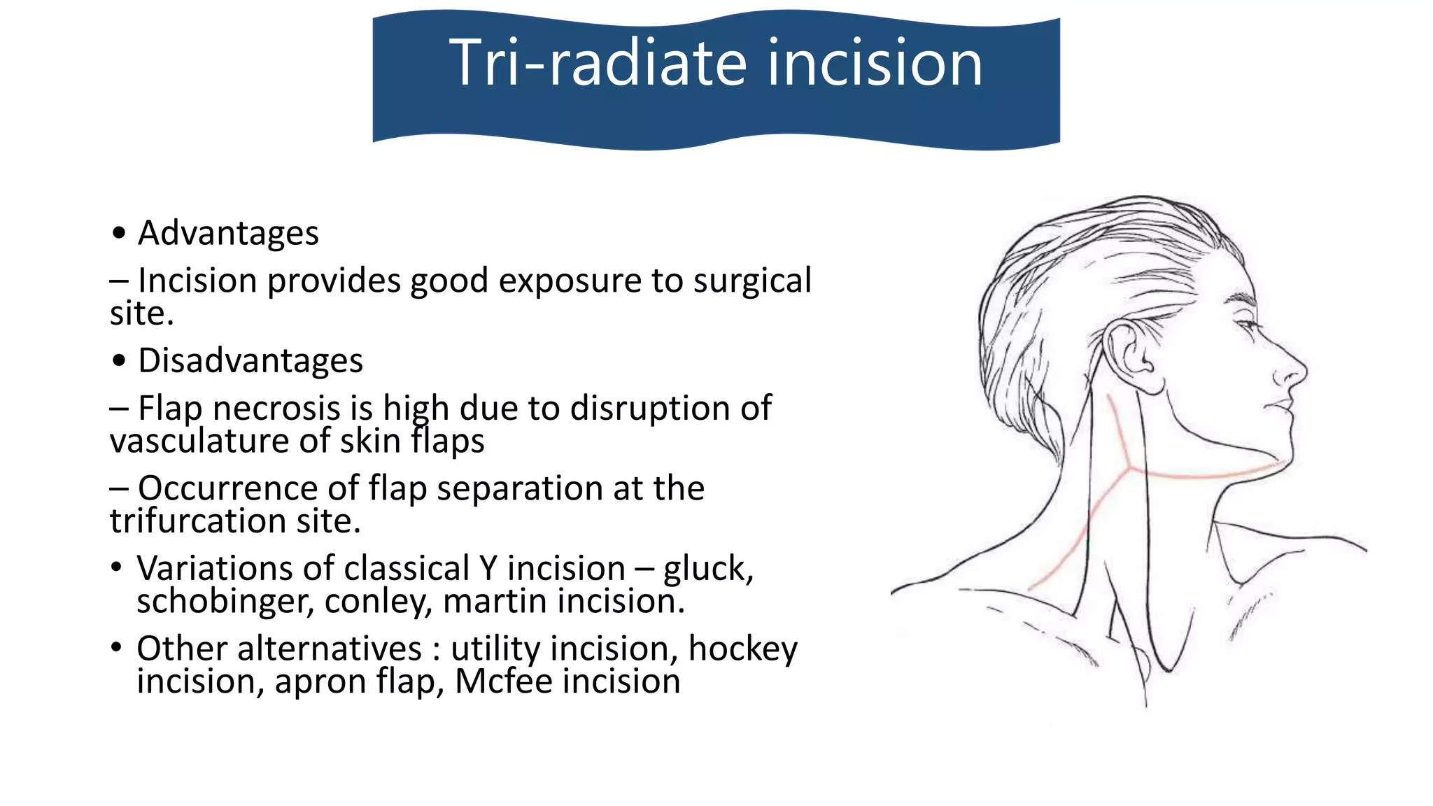 13. neck dissection - Meghali | PPTX