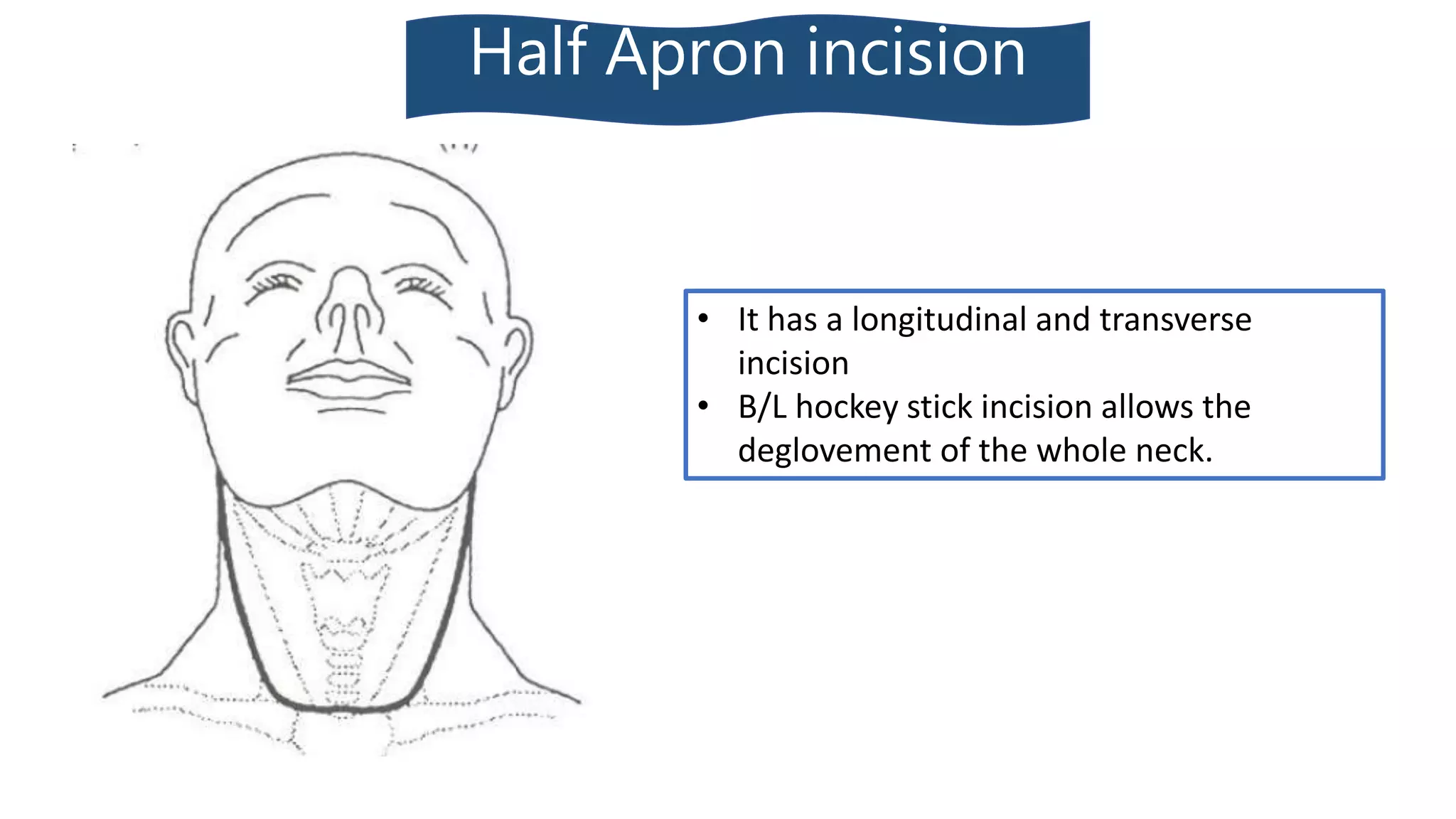 13. neck dissection - Meghali | PPTX