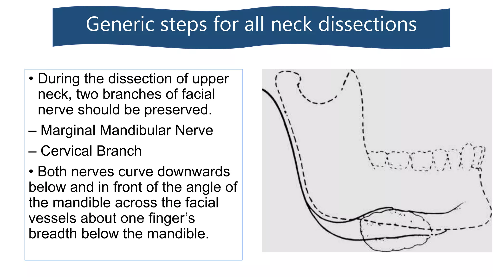13. neck dissection - Meghali | PPTX