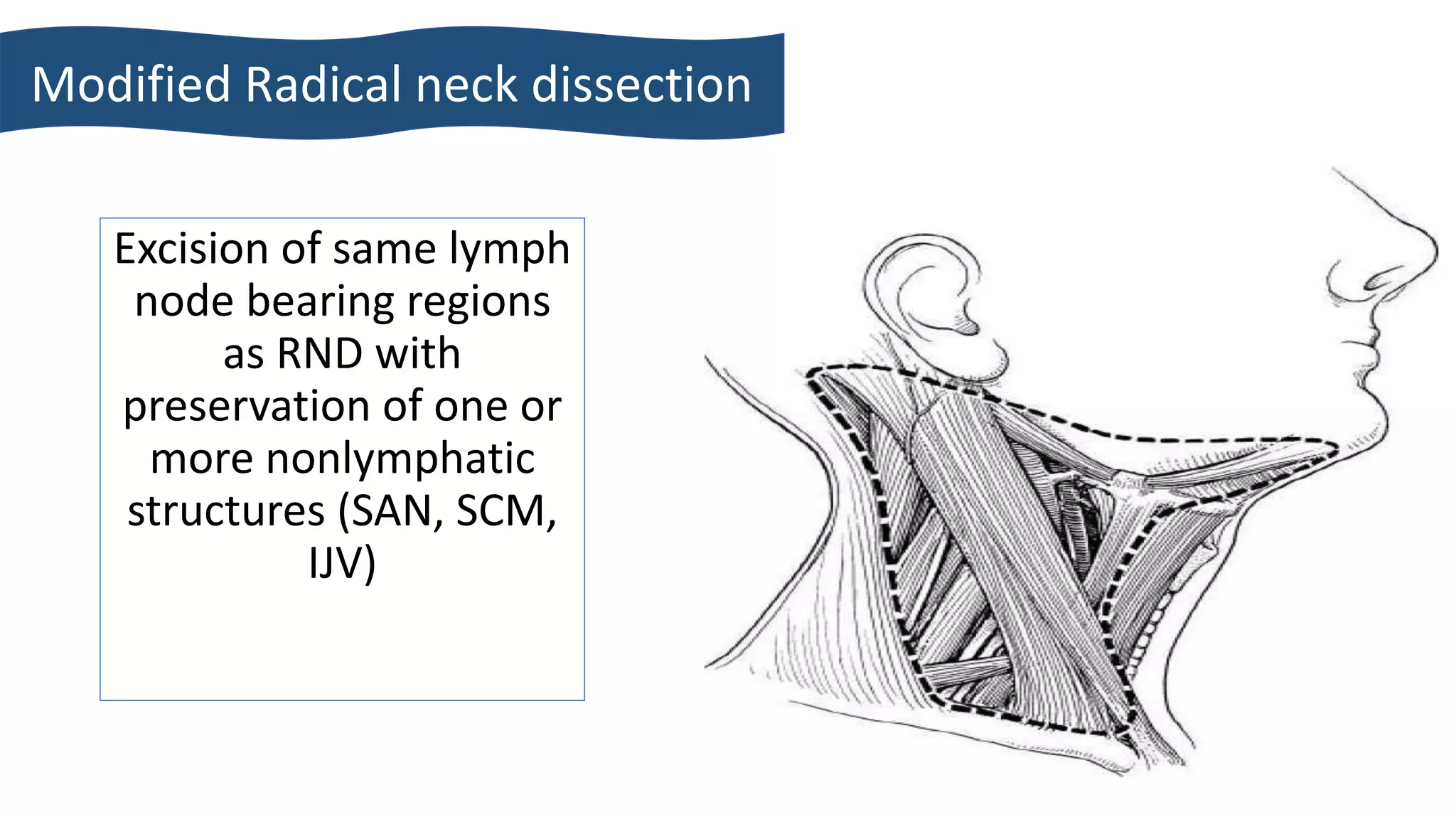 13. neck dissection - Meghali | PPTX