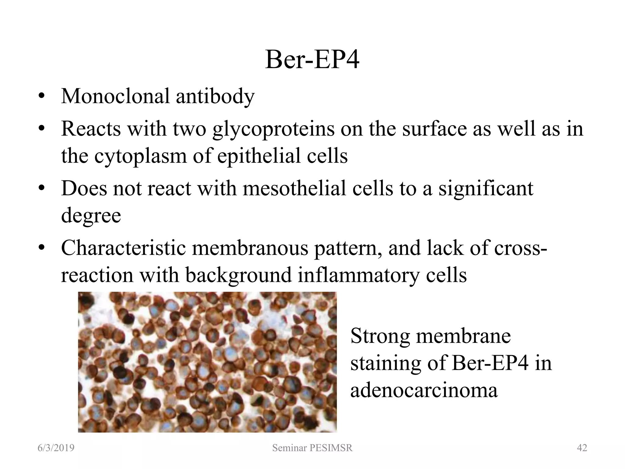 13. role of icc in body fluids | PPTX