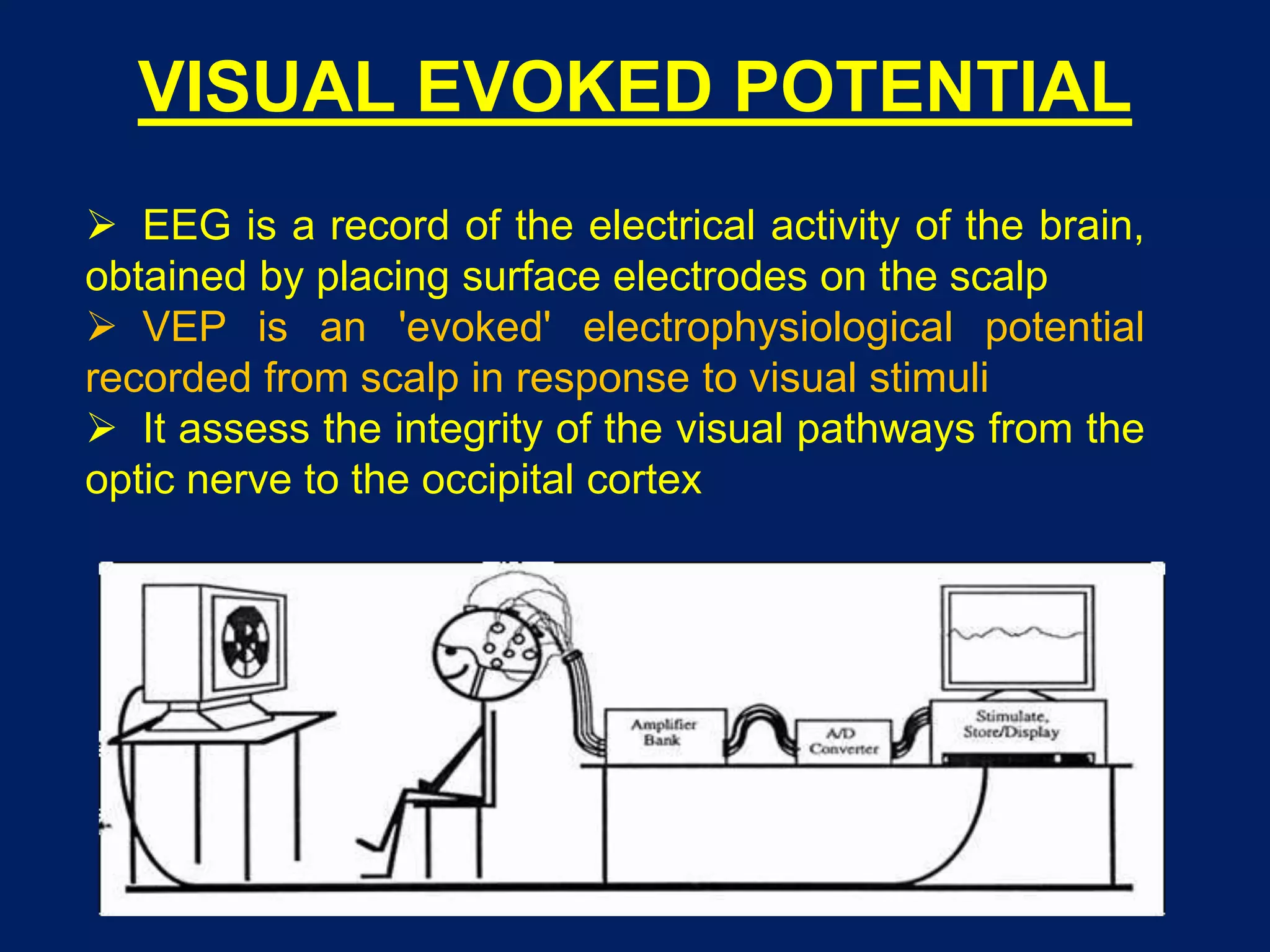 VISUAL EVOKED POTENTIAL | PPT