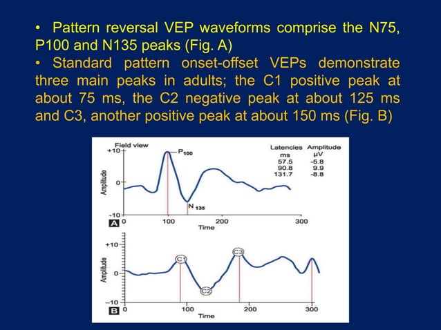 VISUAL EVOKED POTENTIAL | PPT
