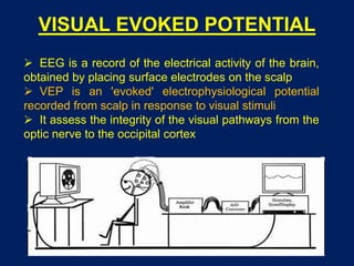 VISUAL EVOKED POTENTIAL | PPT