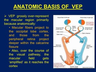 VISUAL EVOKED POTENTIAL | PPT