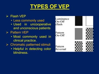 VISUAL EVOKED POTENTIAL | PPT