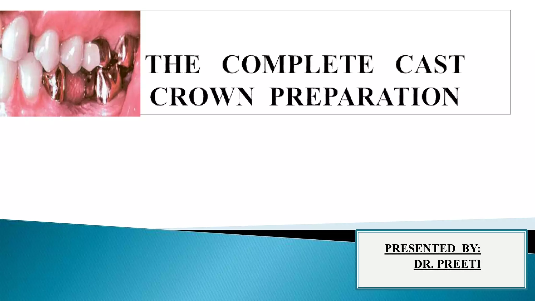 THE COMPLETE CAST PREPARATION | PPTX