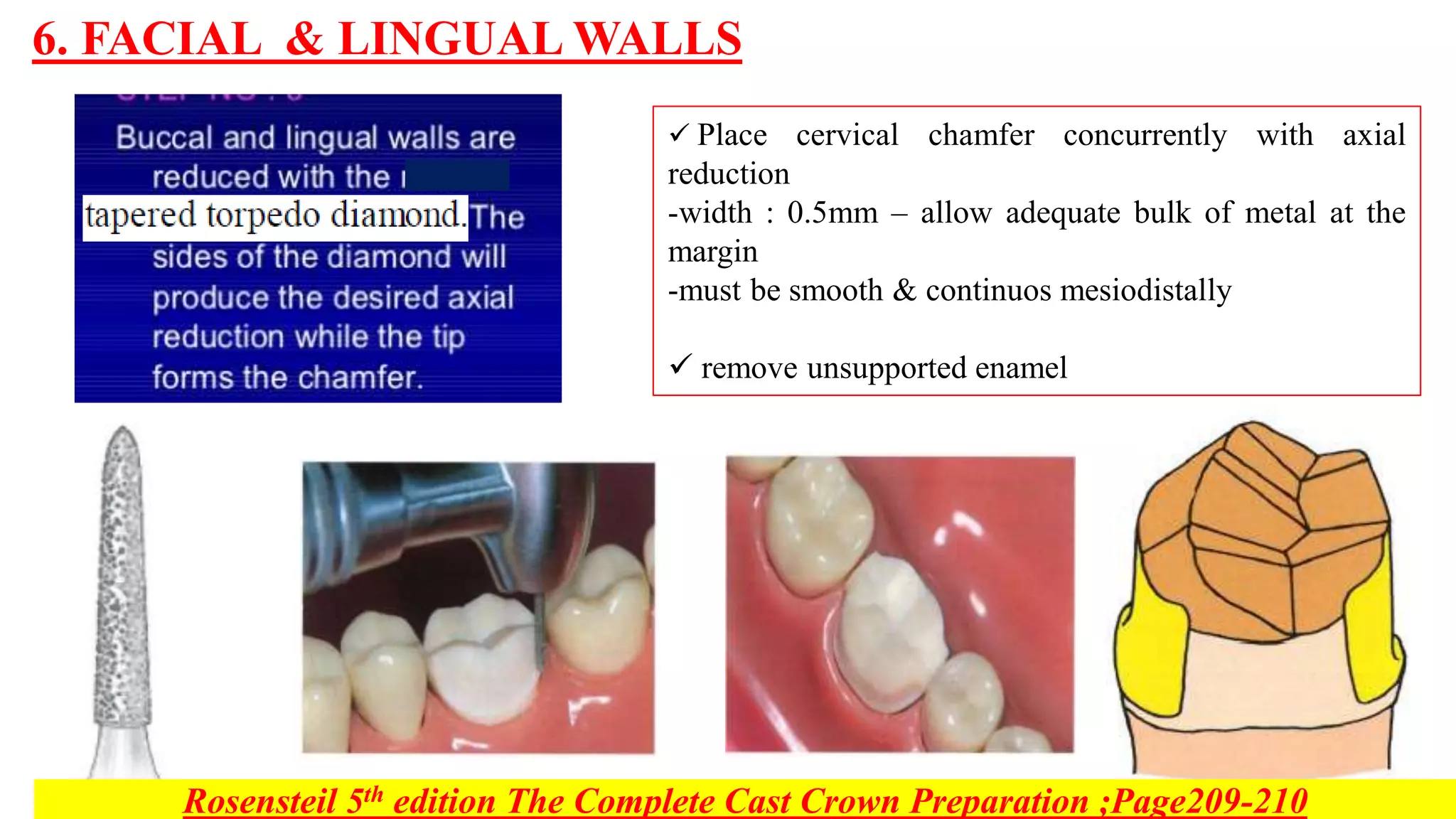 THE COMPLETE CAST PREPARATION | PPTX