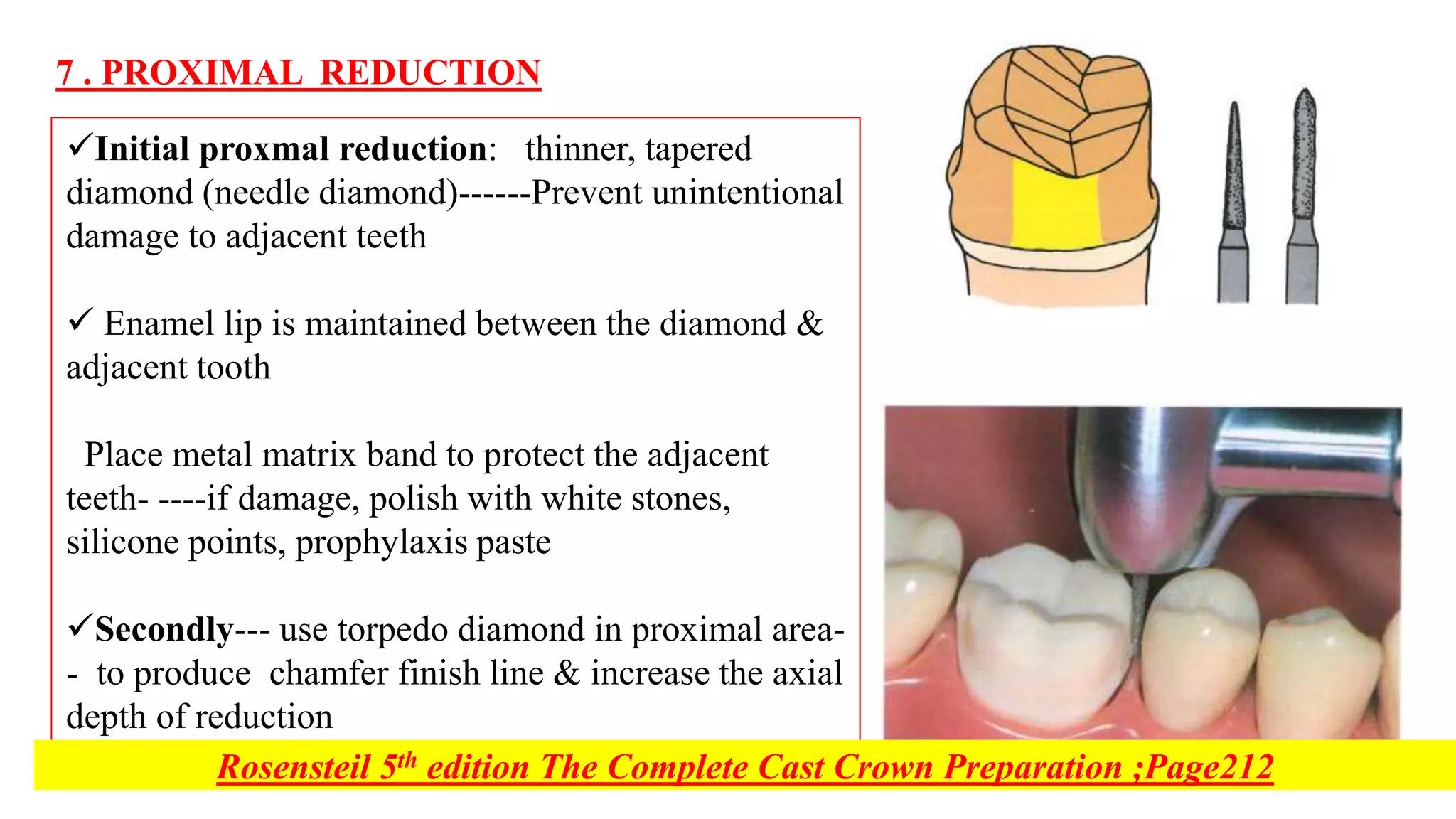 THE COMPLETE CAST PREPARATION | PPTX