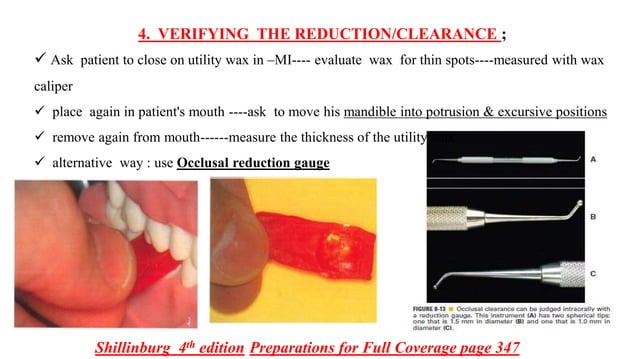 THE COMPLETE CAST PREPARATION | PPTX | Dental Health | Diseases and ...