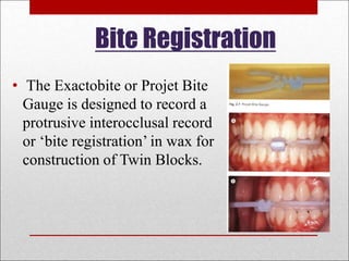 TWIN BLOCK APPLIANCE THERAPY | PPT