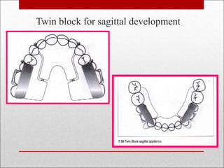 TWIN BLOCK APPLIANCE THERAPY | PPT