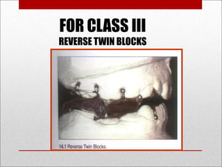 TWIN BLOCK APPLIANCE THERAPY | PPT
