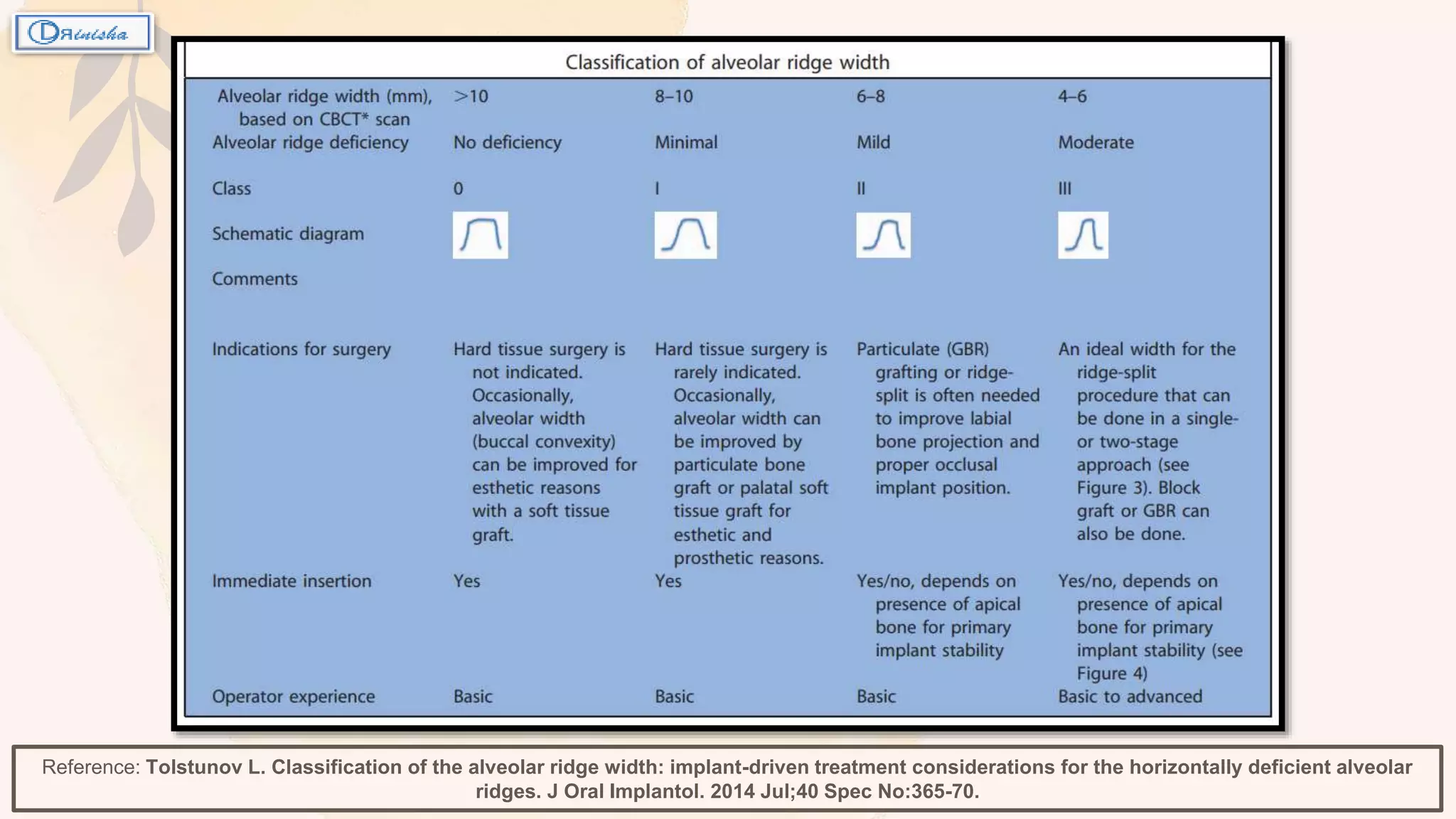 Ridge Split Techniques.pptx