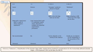 Ridge Split Techniques.pptx