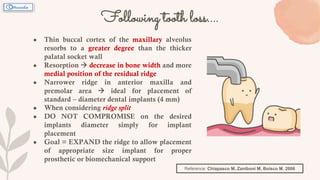 Ridge Split Techniques.pptx