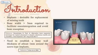 Ridge Split Techniques.pptx