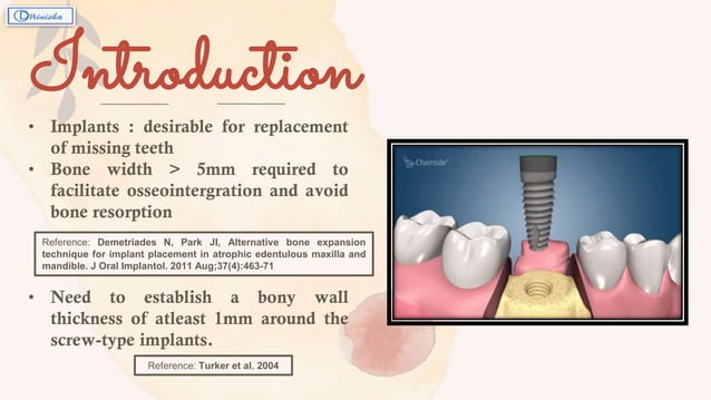 Ridge Split Techniques.pptx