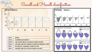 Ridge Split Techniques.pptx