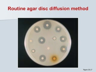 13.Antimicrobial Resistance.pptx