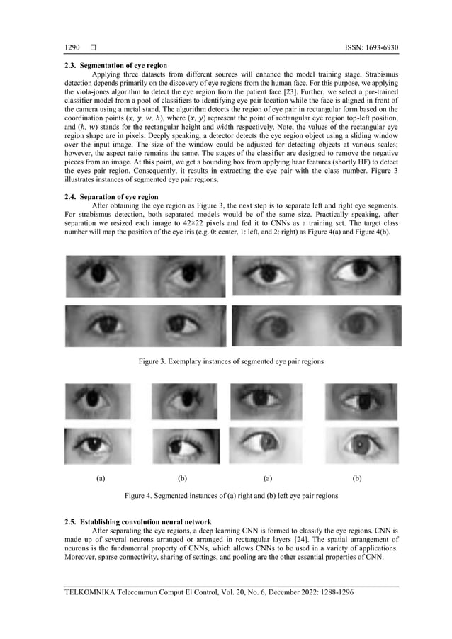 An intelligent strabismus detection method based on convolution neural network | PDF