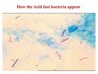 13.Staining technique.pptx | Chemistry | Science