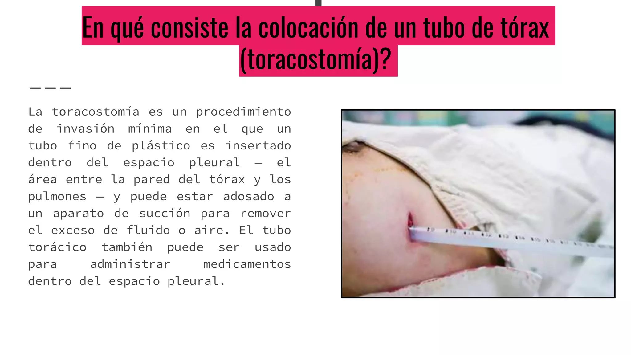 13. Manejo del Tubo de Tórax Pleural nuevo 2020.pptx