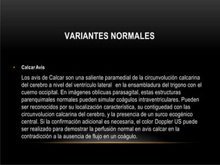 13. ANATOMÍA RADIOLÓGICA DEL SISTEMA NERVIOSO CENTRAL POR ECOGRAFÍA ...