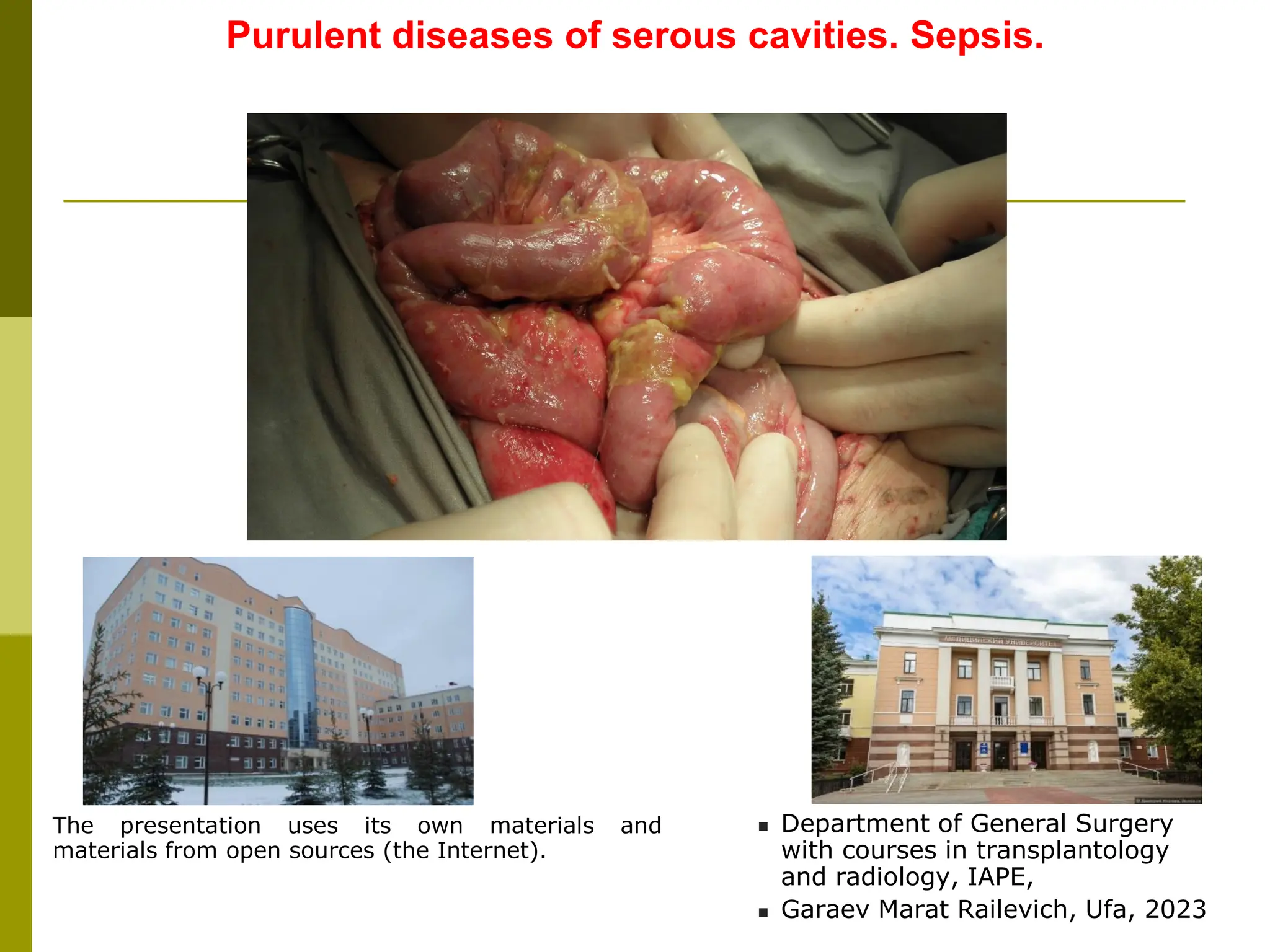 Purulent diseases of serous cavities. Sepsis (lecture 13).pdf