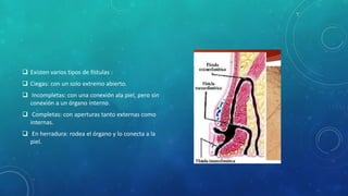 Fistulogramaaaaaaaaaaaaaaaaaaaaaaaaaaaaaaaaaaaaaaaaa | PDF