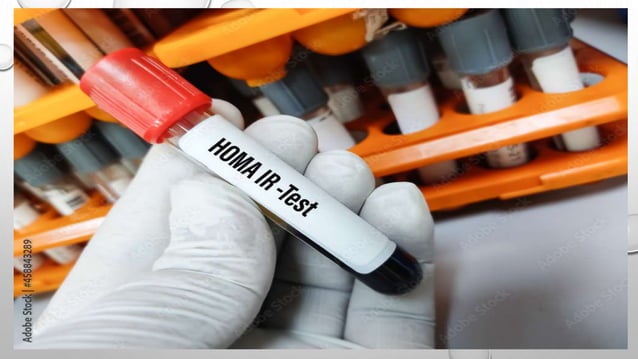 faculty of medicine l (homa IR-test).pptx | Endocrine and Metabolic ...
