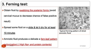 13. PROM premature rupture of membranes | PPTX