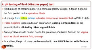 13. PROM premature rupture of membranes | PPTX