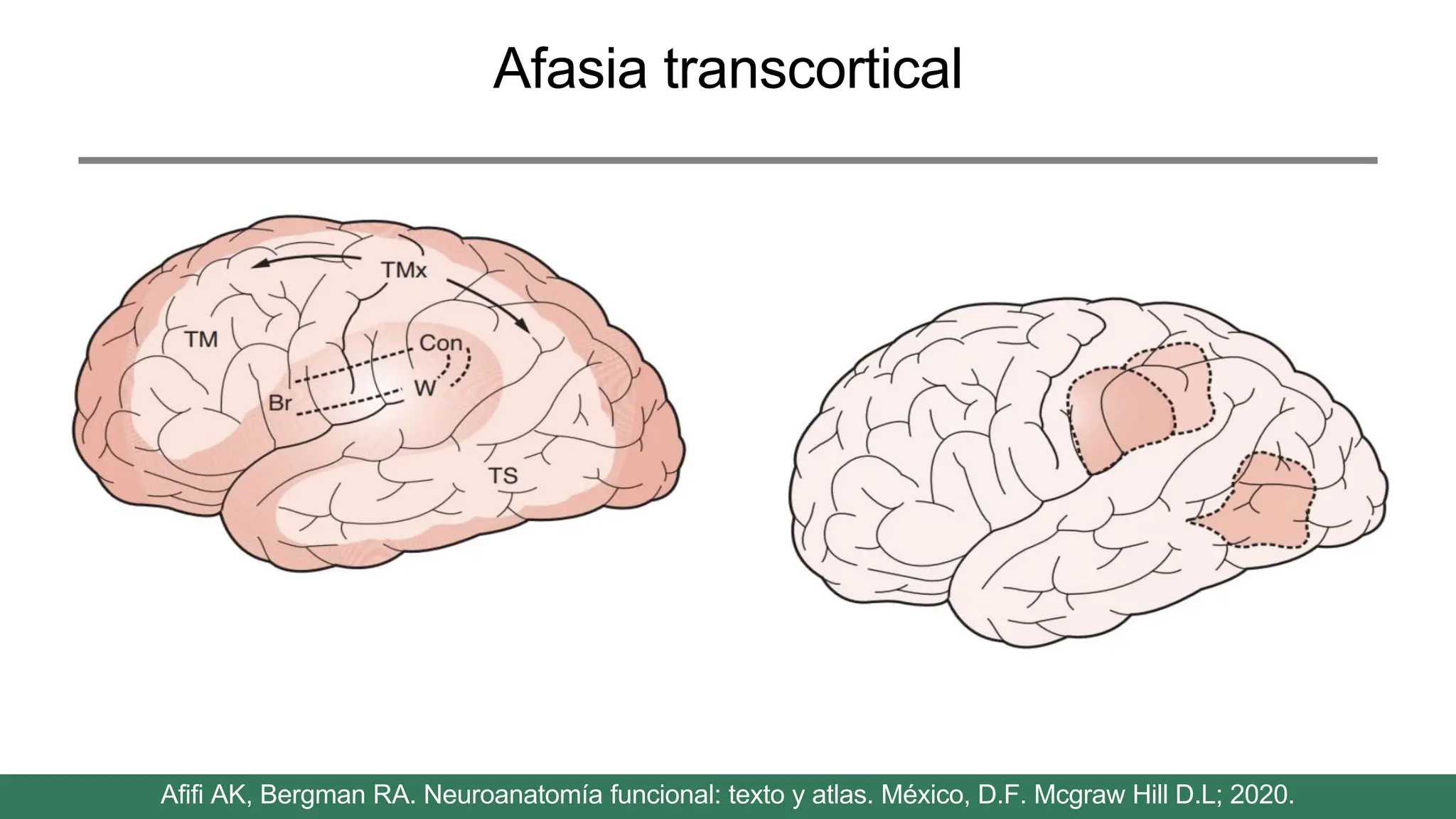 13. Afasia, alexia y agrafia. Presentación basica | PPTX | Brain and ...