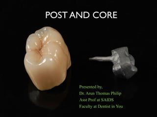 PROSTHODONTIC MANAGEMENT OF ENDODONTICALLY TREATED TEETH | PPTX