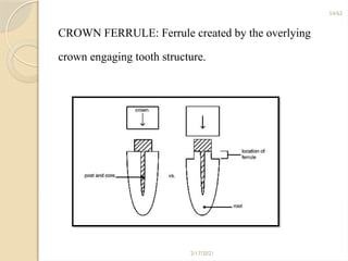 PROSTHODONTIC MANAGEMENT OF ENDODONTICALLY TREATED TEETH | PPTX